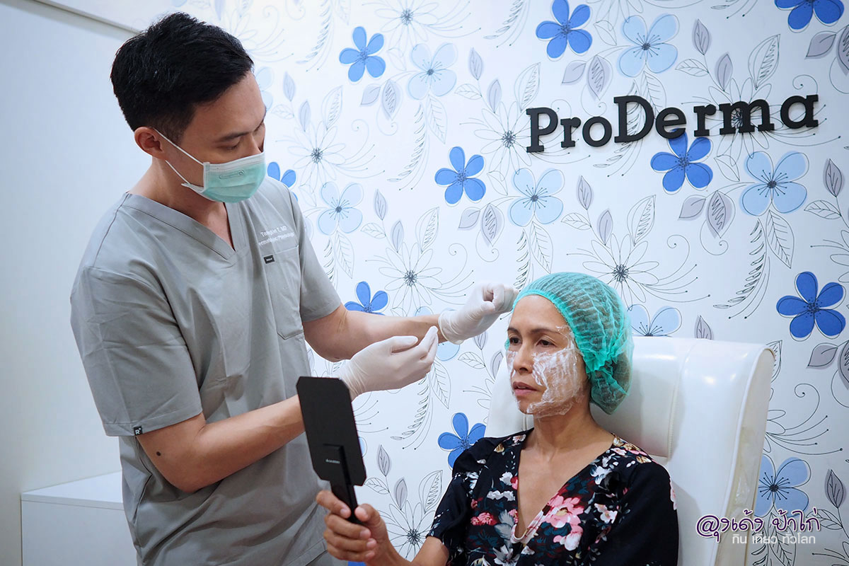 ฟิลเลอร์ร่องแก้ม ใต้ตา ยกหน้า ProDerma Clinic - รีวิว by ลุงเด้ง ป้าไก่