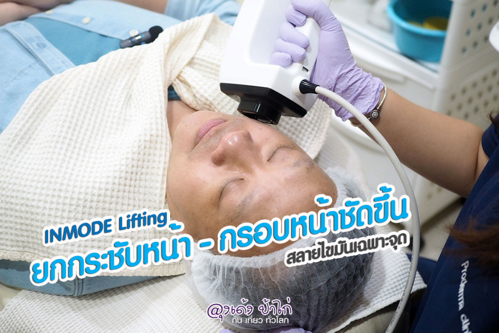 InMode Lifting รีวิว ยกกระชับ กรอบหน้าชัดขึ้น : Proderma - รีวิว by ลุง ...